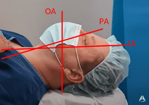 Optimal Patient Positioning for intubation and airway management – The ...