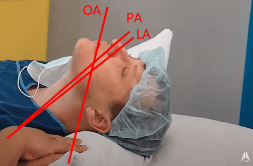 Optimal Patient Positioning for intubation and airway management – The ...
