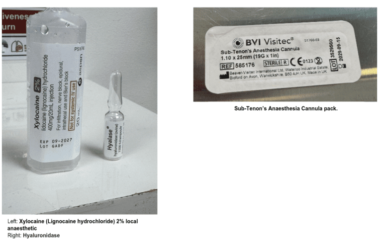 The Sub-Tenon Block: Technique, Advantage and Complications – The ...